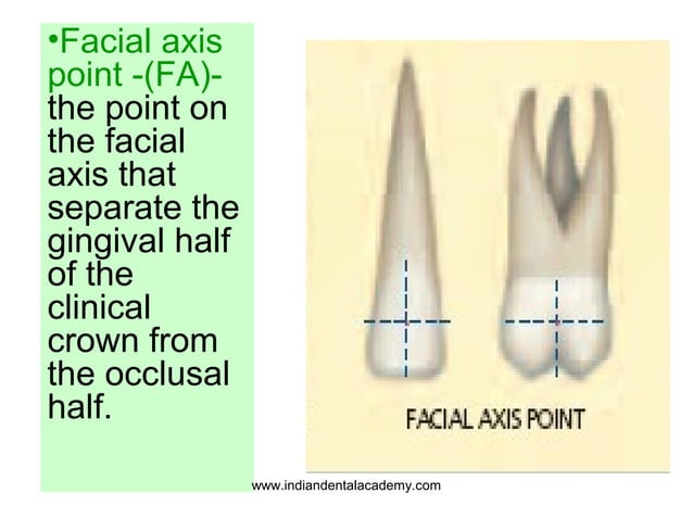Andrew’s straight wire appliance /certified fixed orthodontic courses ...