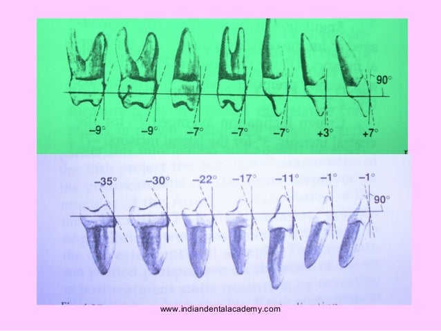 Andrew’s straight wire appliance /certified fixed orthodontic courses…