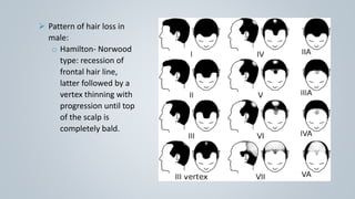 Androgenetic alopecia | PPTX