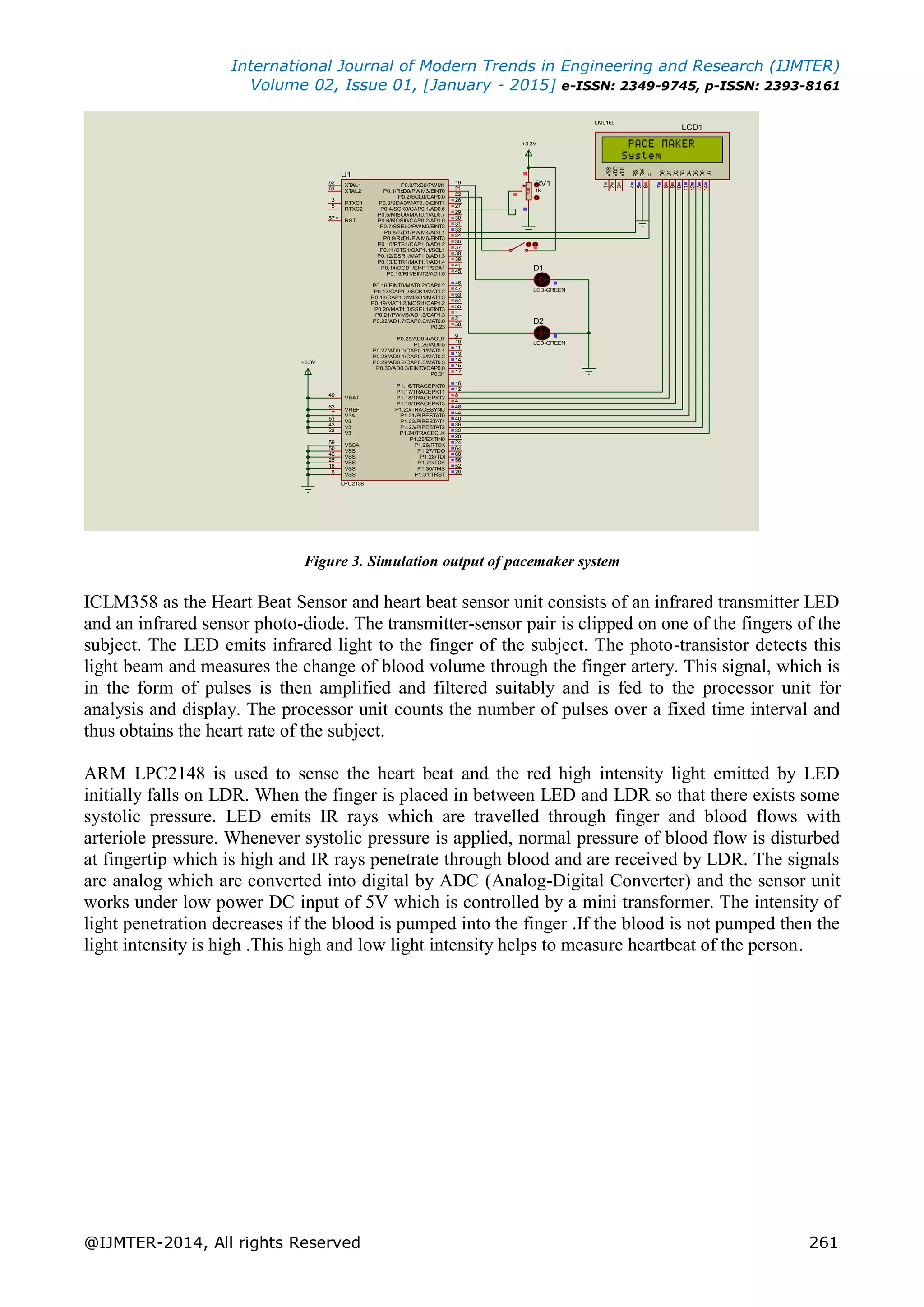 Android based Fail Safe Dual Chamber Cardiac Integrated Pacemaker ...