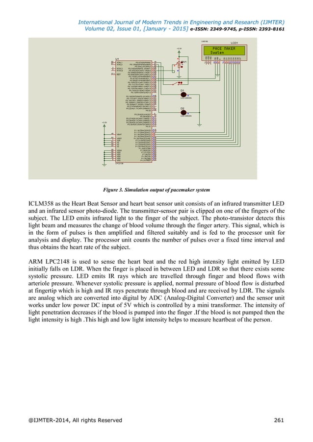 Android based Fail Safe Dual Chamber Cardiac Integrated Pacemaker ...