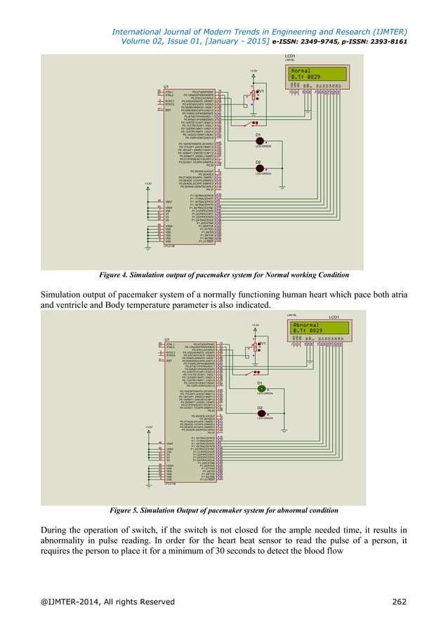 Android based Fail Safe Dual Chamber Cardiac Integrated Pacemaker ...
