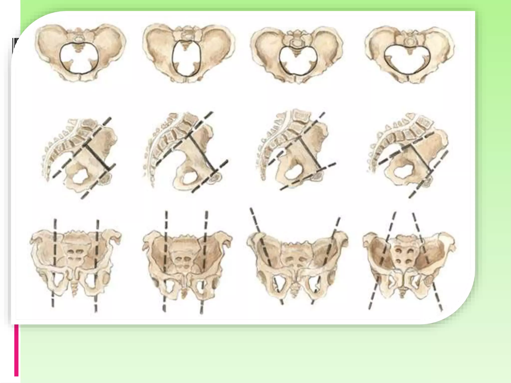 Android pelvis | PPTX