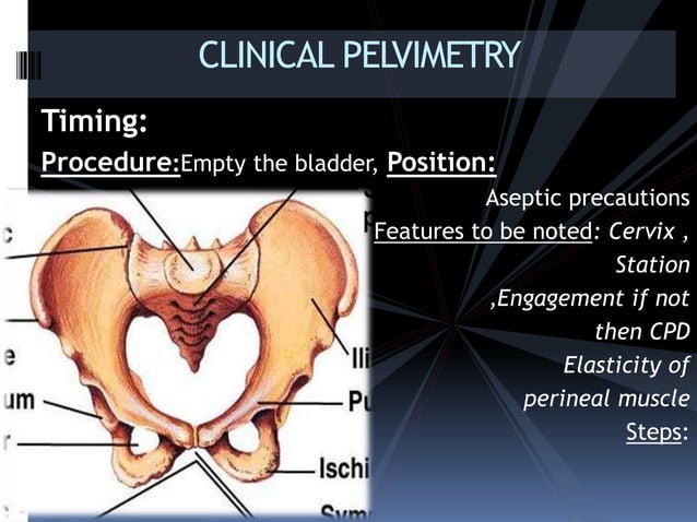 Android pelvis | PPTX