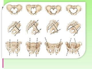 Android pelvis | PPTX
