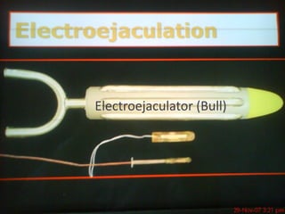 Andrology (3) Extra Tazbeet(semen collection)final | PPT