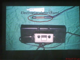 Andrology (3) Extra Tazbeet(semen collection)final | PPT