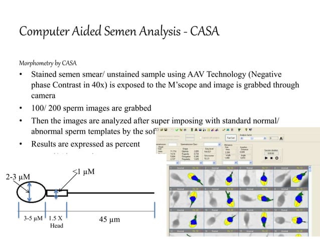 Andrology lab | PPTX | Infertility | Reproductive Health