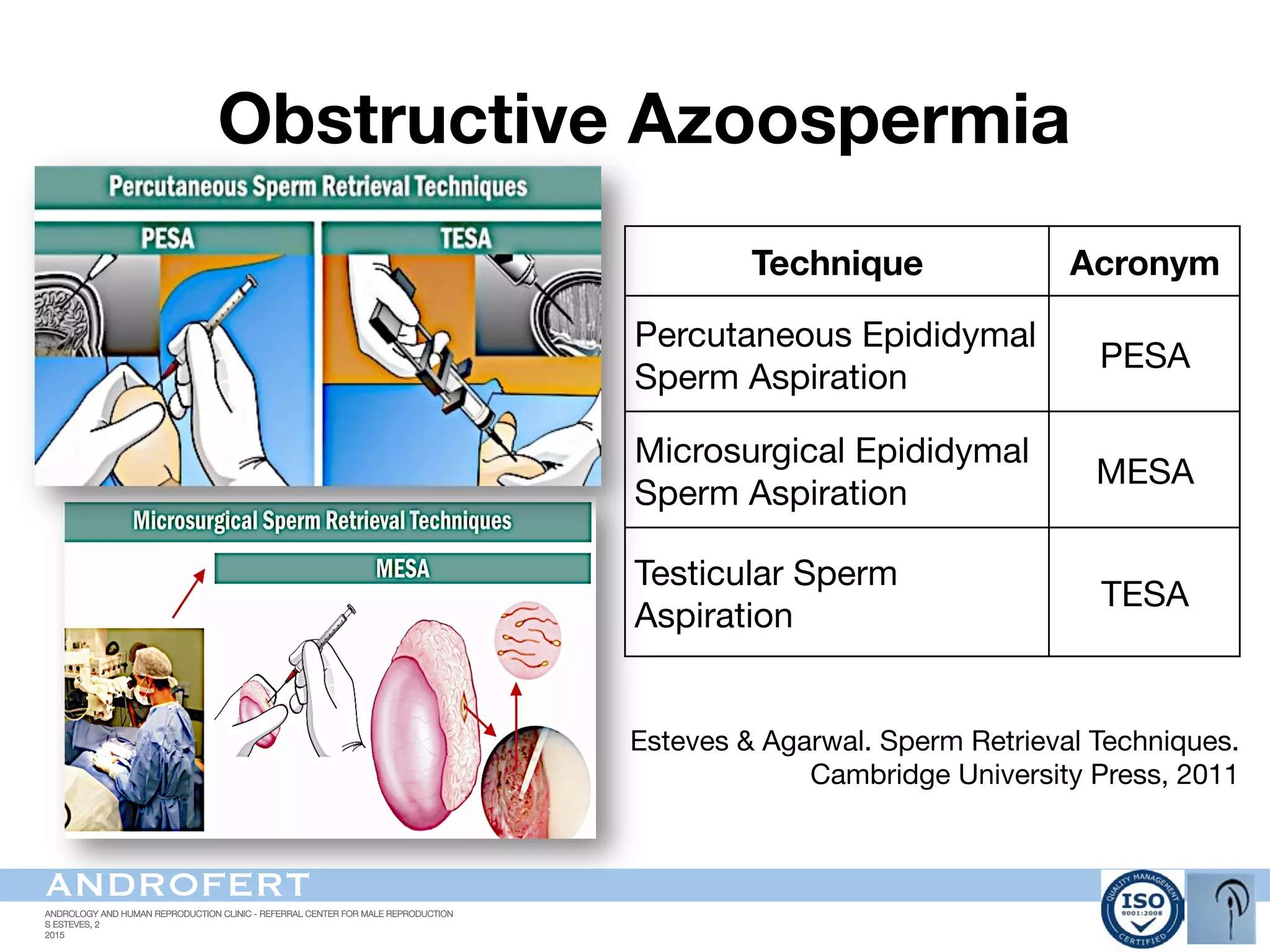 Andrology Workshop - PESA/MESA/TESA/Micro-TESE | PDF