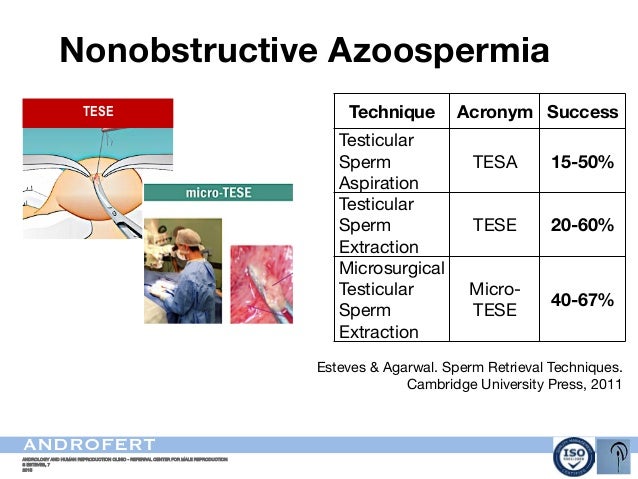 Andrology Workshop - PESA/MESA/TESA/Micro-TESE