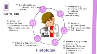 Síndrome de Hamman Rich (Fibrosis intersticial idiopática) | PPTX