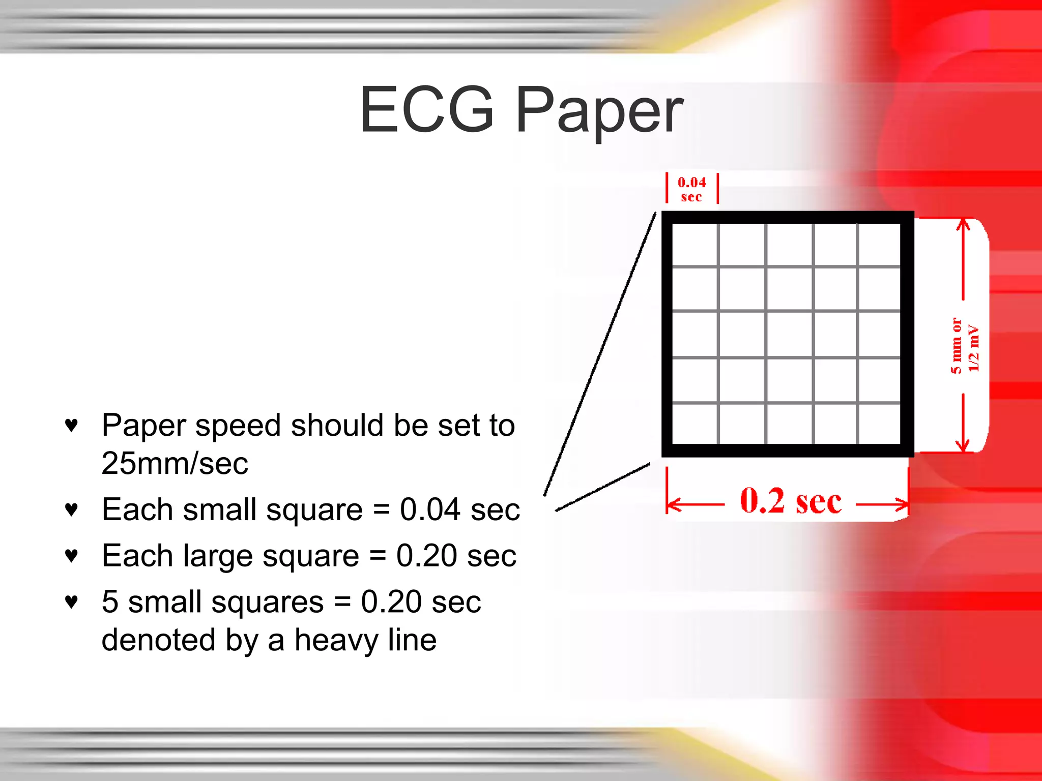 An ECG workshop | PPT