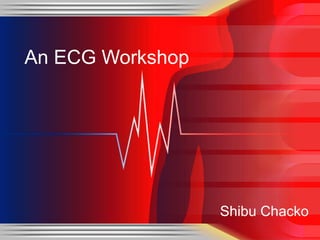 An ECG workshop | PPT
