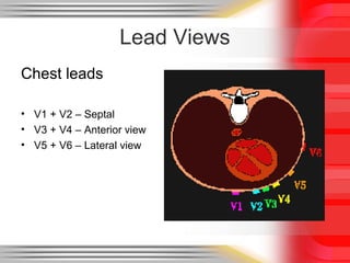 An ECG workshop | PPT