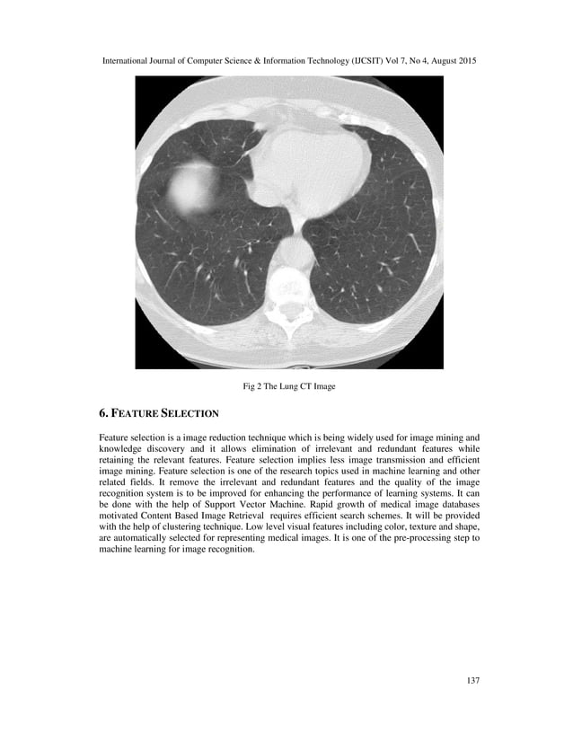 An Effective And Efficient Feature Selection Method For Lung Cancer Detection Pdf