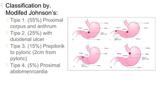 Gastric Perforation | PPT