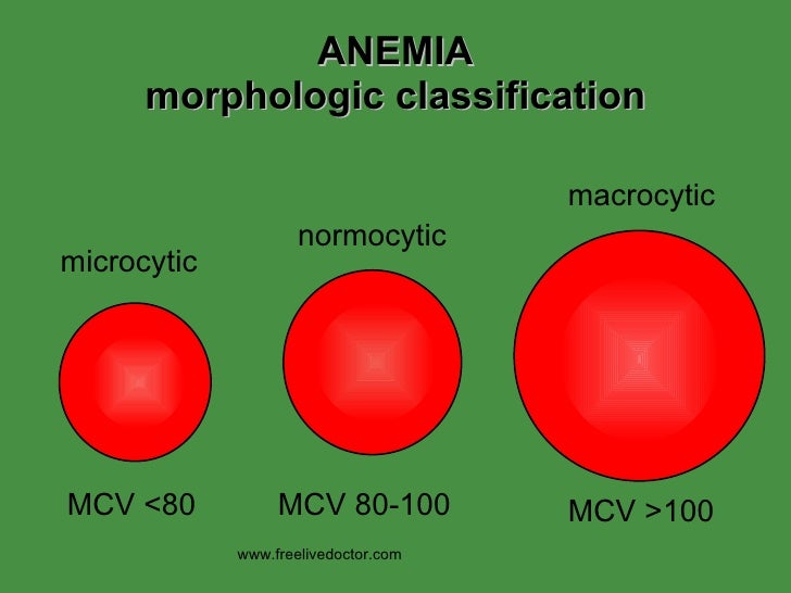 Anemia