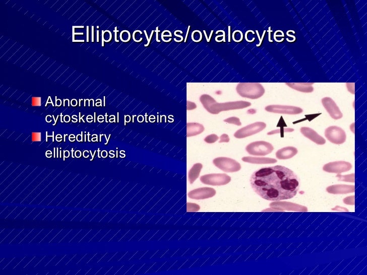 Medicine 5th year, 5th & 6th lectures (Dr. Sabir)