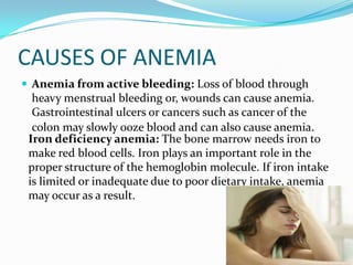 Anemia | PPTX