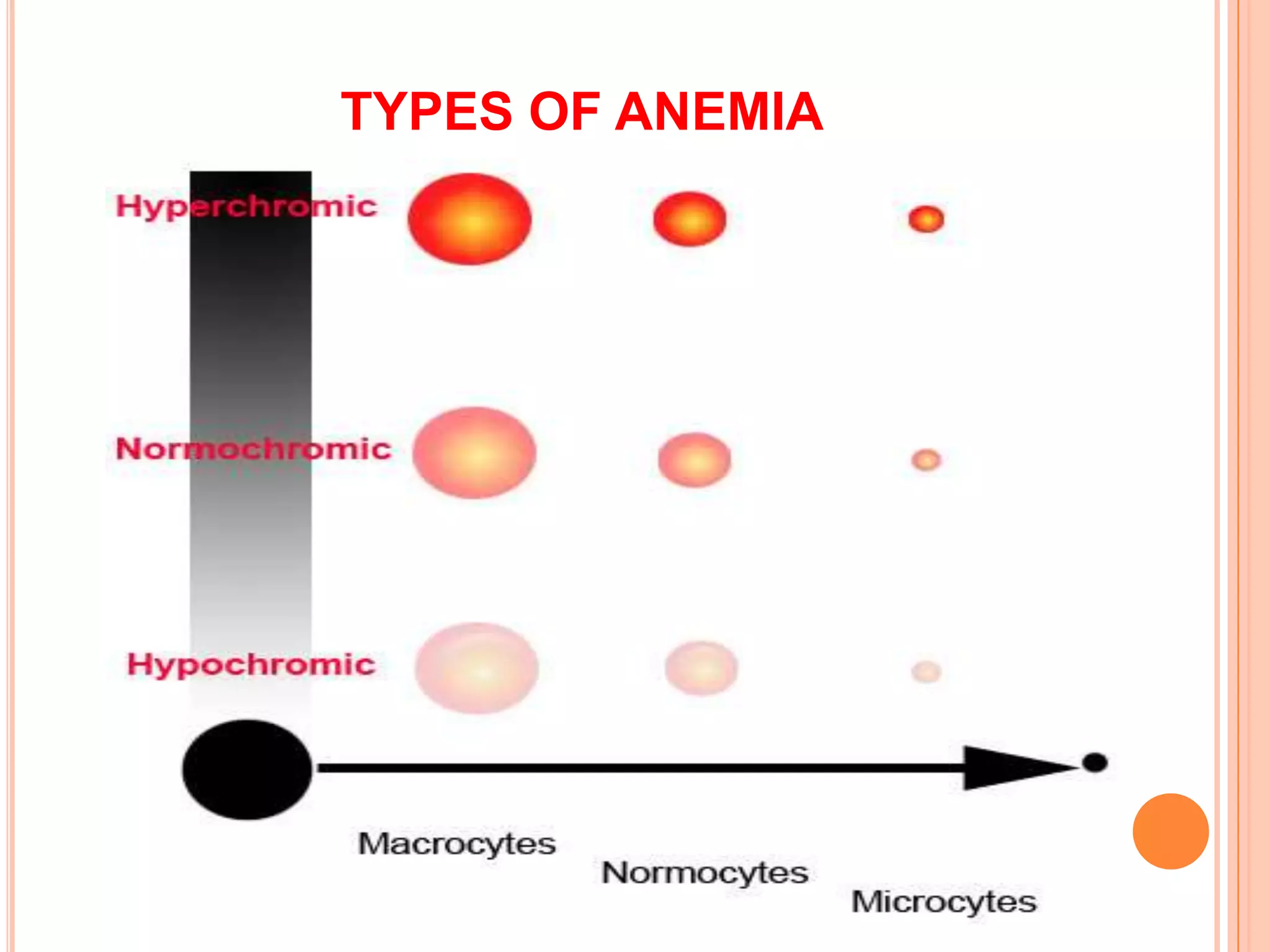 Anemia | PPTX