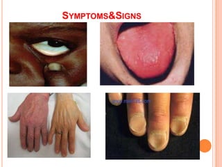Anemia Symptoms Skin