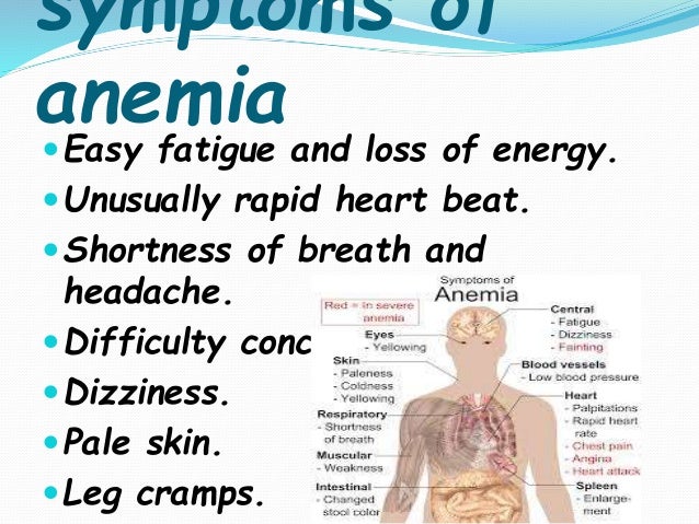 Anemia