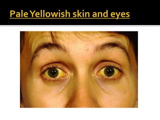 Pale Face Anemia