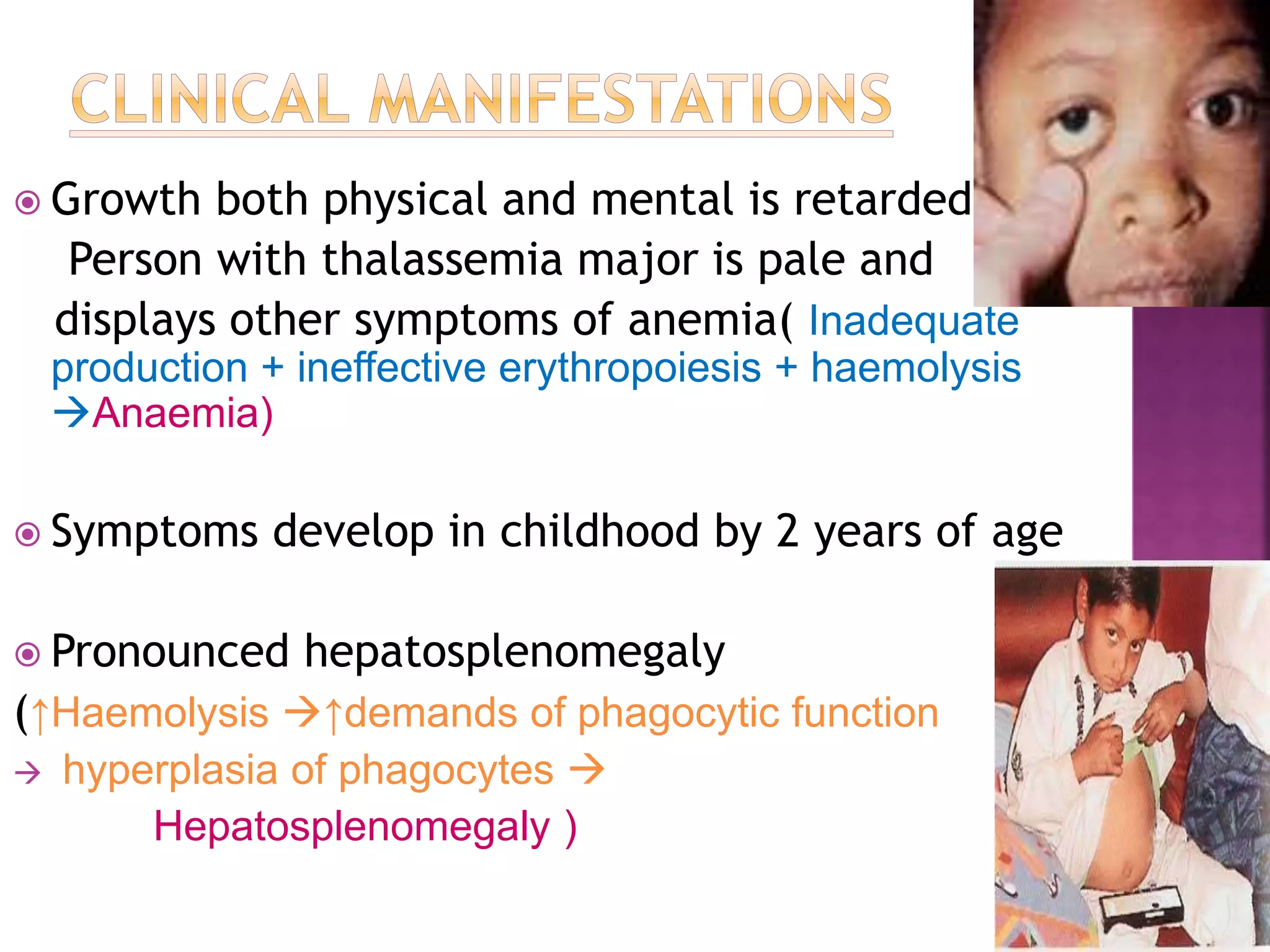 Anemia | PPTX