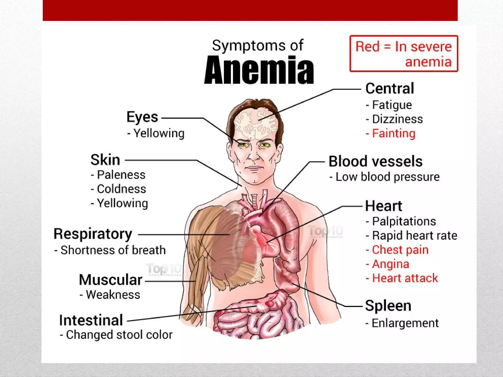 Anemia and drug use for the treatment of Anemia | PPT