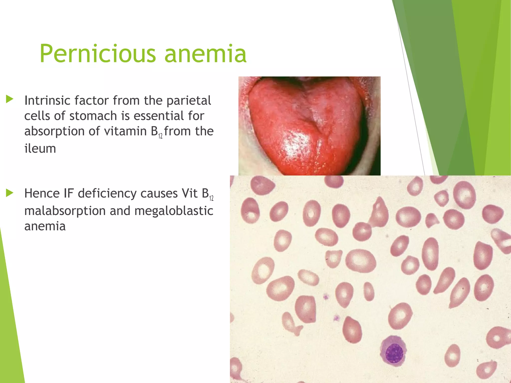 Anemia | PPT