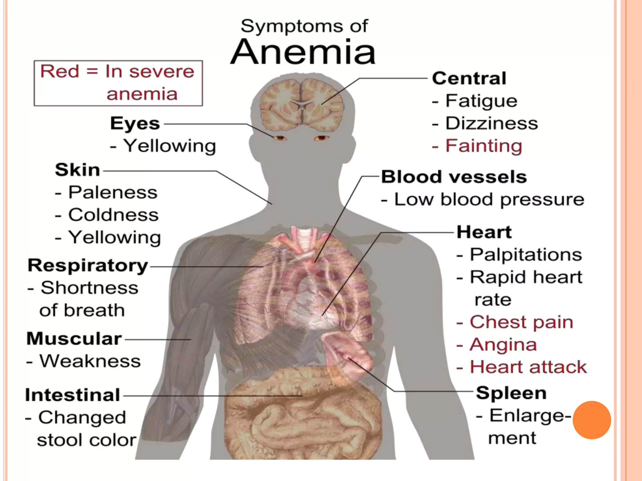 Anemia | PPT