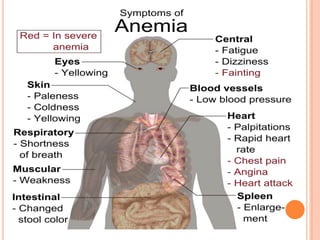 Anemia | PPT