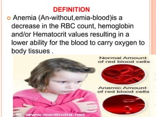 Anemia | PPT