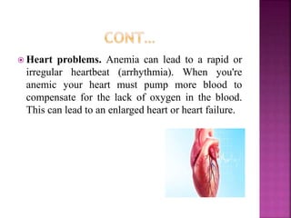 Anemia | PPTX