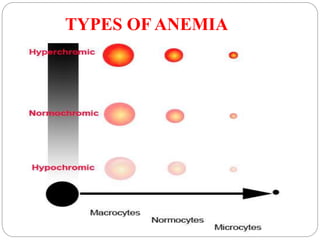 Anemia | PPTX | Blood Disorders | Diseases and Conditions
