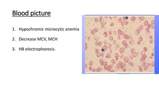 Anemia | PPTX