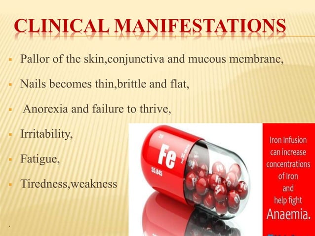 Anemia in child | PPTX