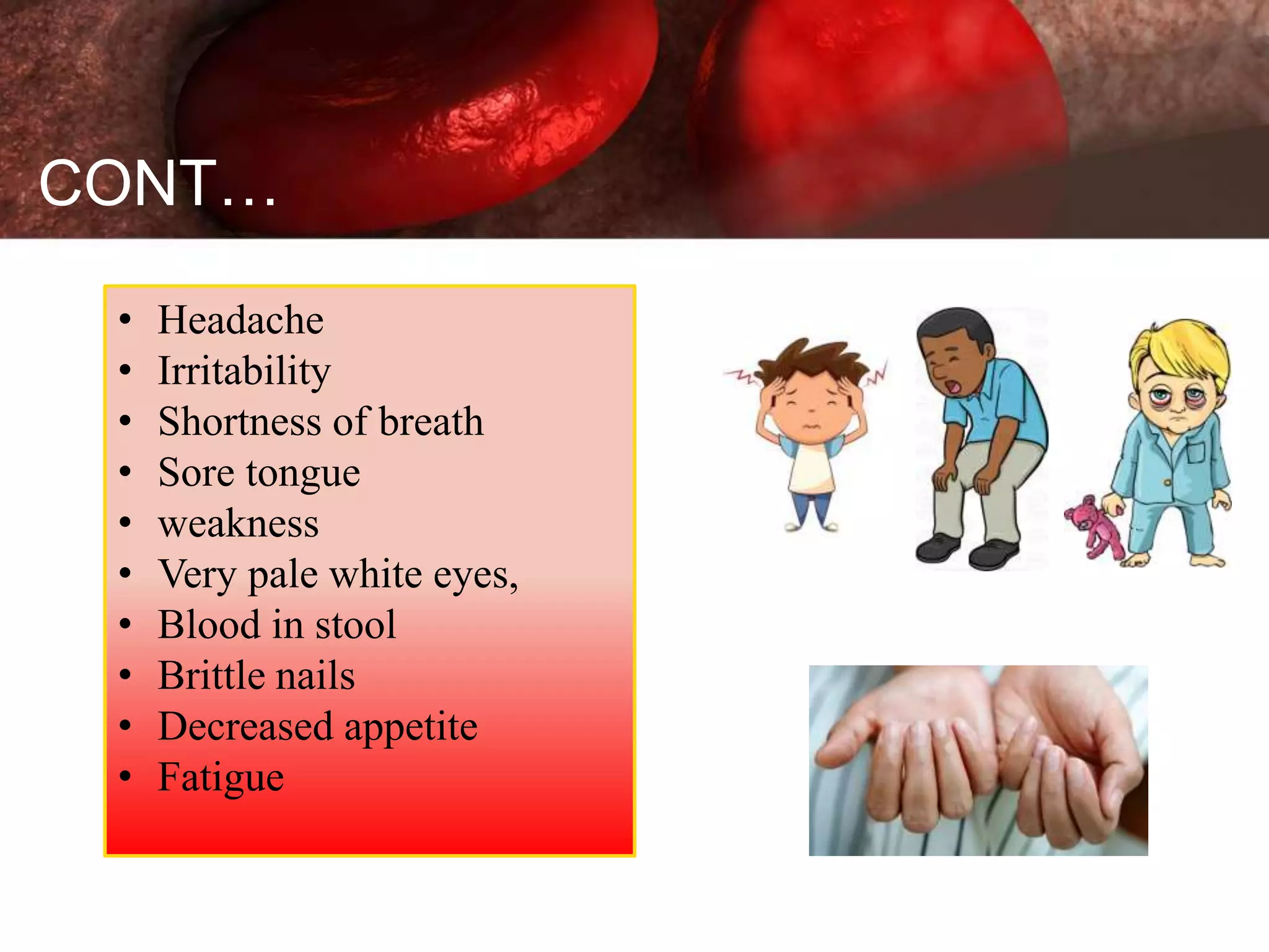ANEMIA IN PEDIATRICS: IRON DEFICIENCY ANEMIA, MEGALOBLASTIC ANEMIA ...