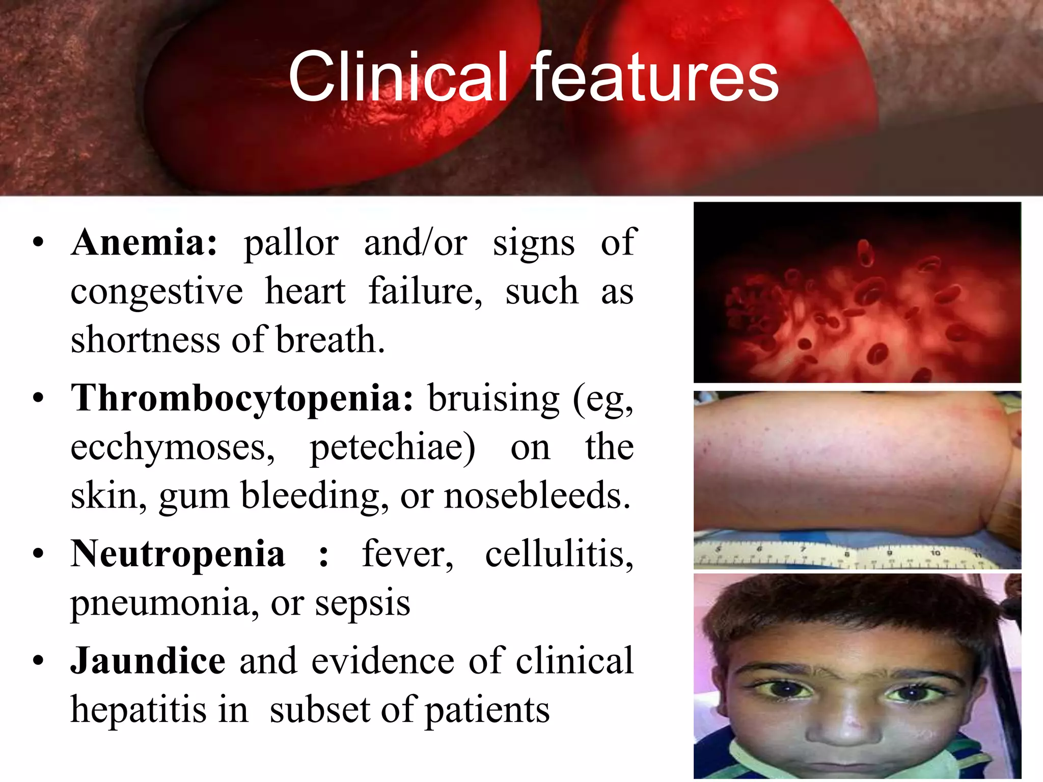 ANEMIA IN PEDIATRICS: IRON DEFICIENCY ANEMIA, MEGALOBLASTIC ANEMIA ...