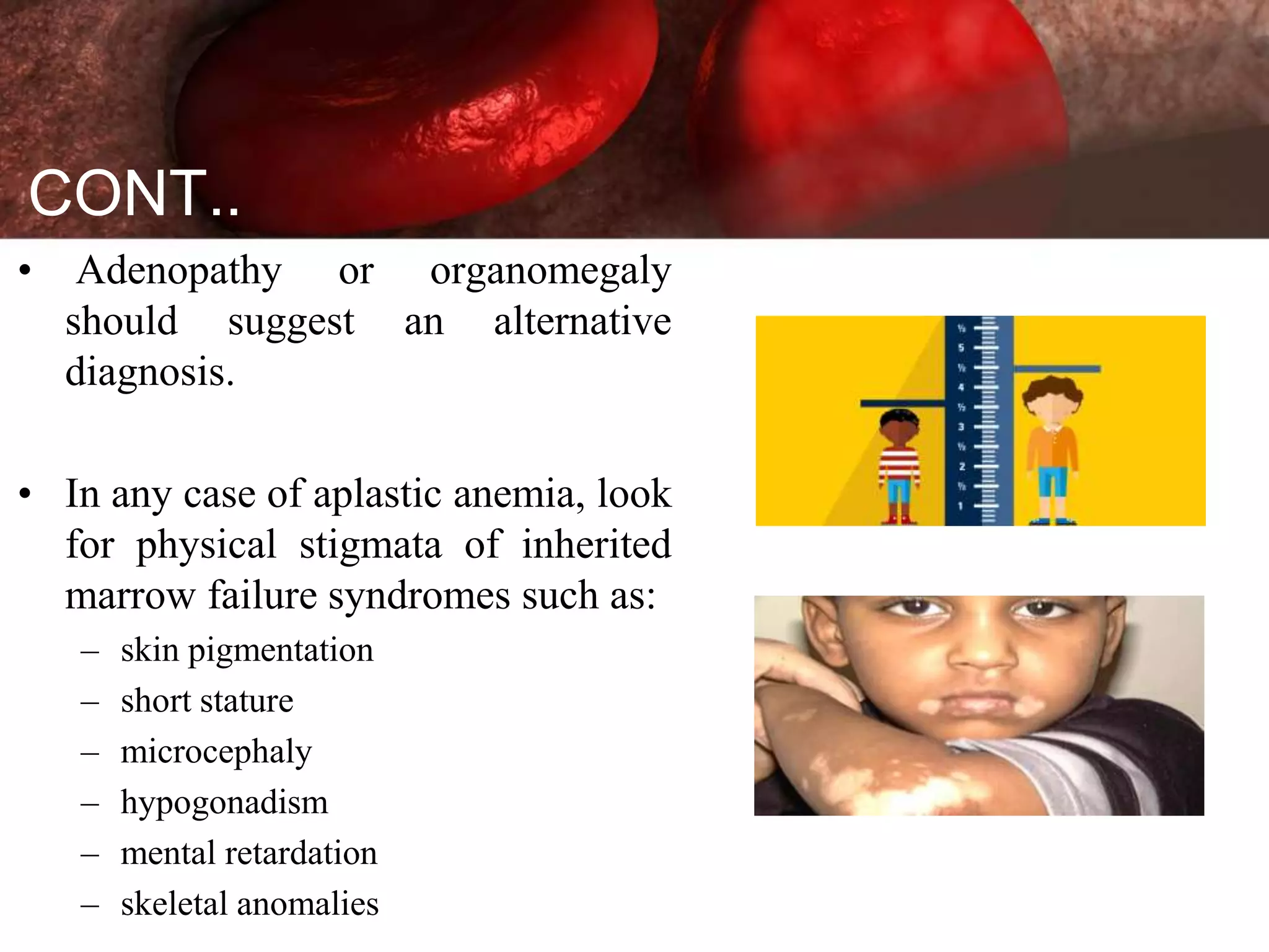 ANEMIA IN PEDIATRICS: IRON DEFICIENCY ANEMIA, MEGALOBLASTIC ANEMIA ...