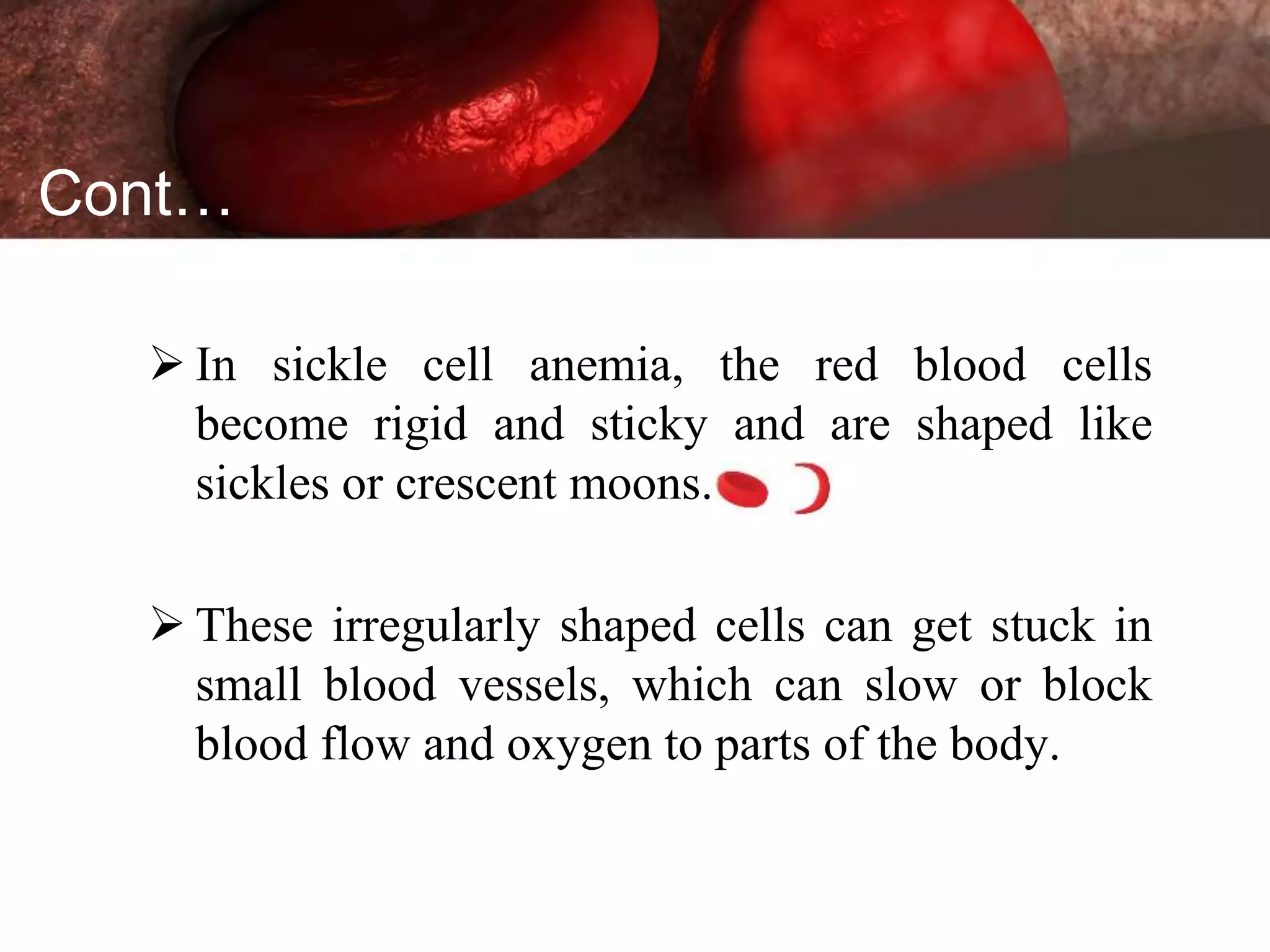 ANEMIA IN PEDIATRICS: IRON DEFICIENCY ANEMIA, MEGALOBLASTIC ANEMIA ...