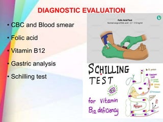 Anemia | PPTX