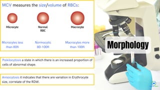 Overview of Anemia | PPT