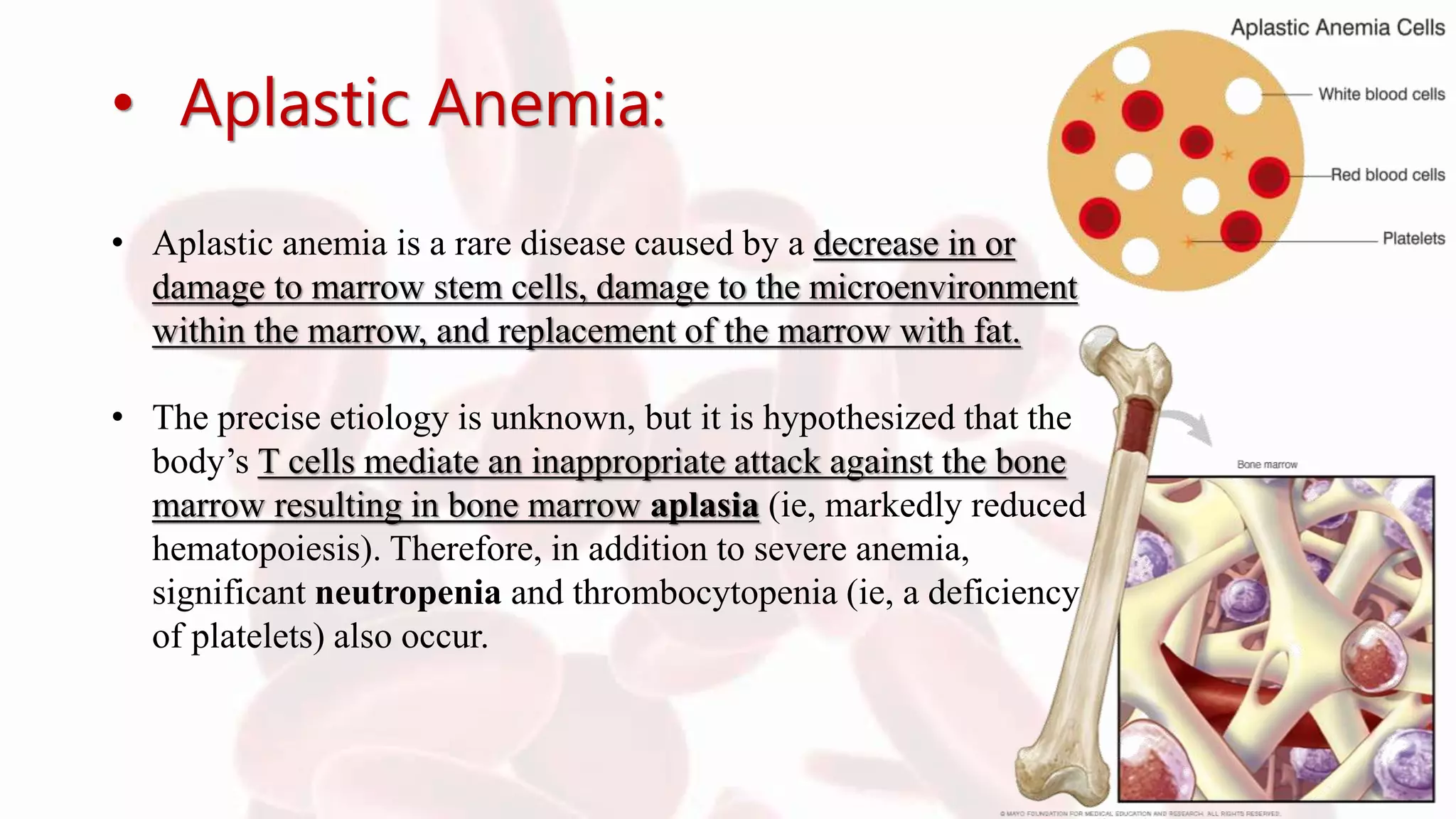 Anemia | PPTX