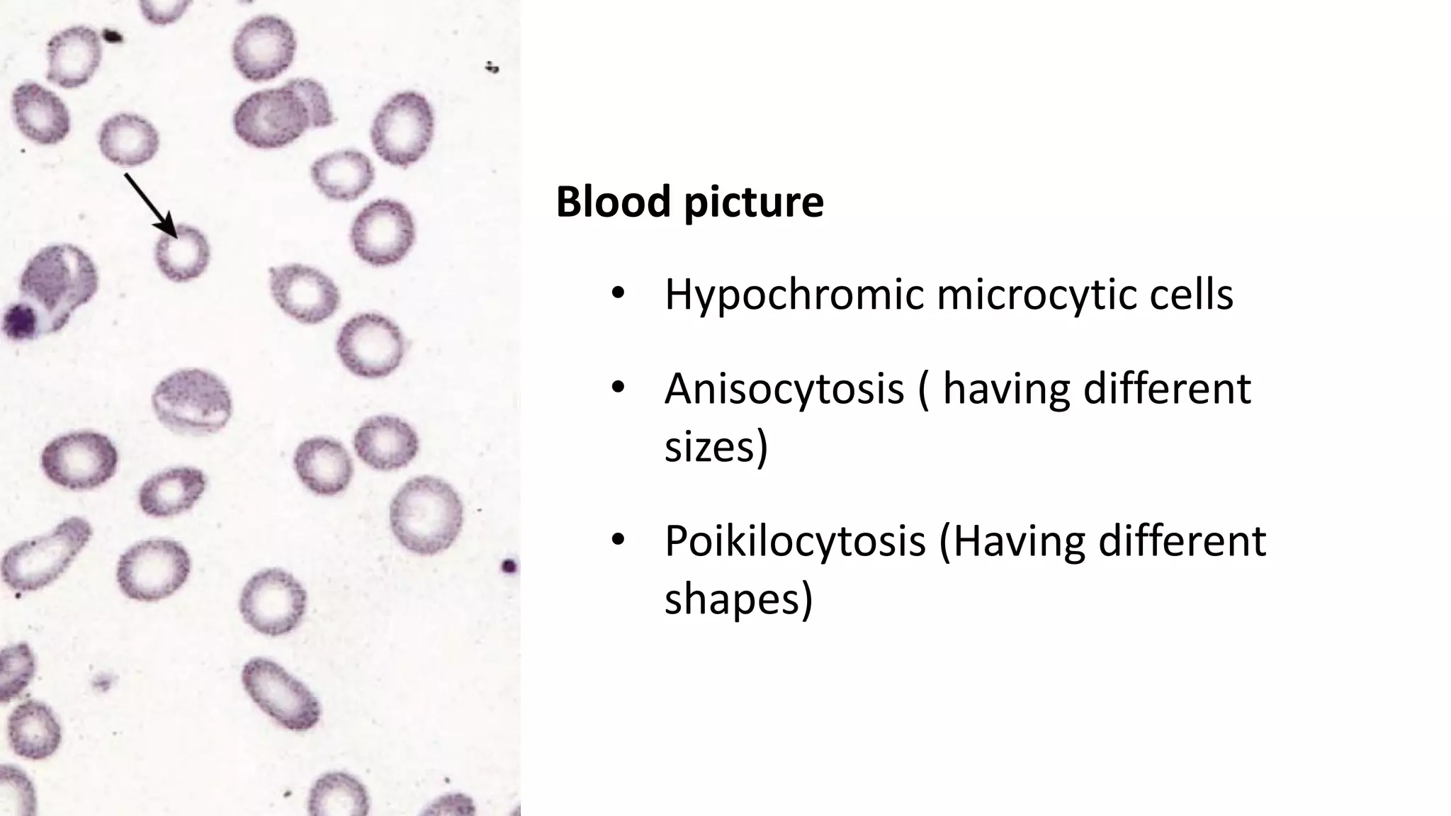 Anemia.pdf | Pregnancy | Reproductive Health
