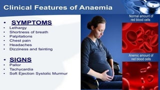anemia.pptx