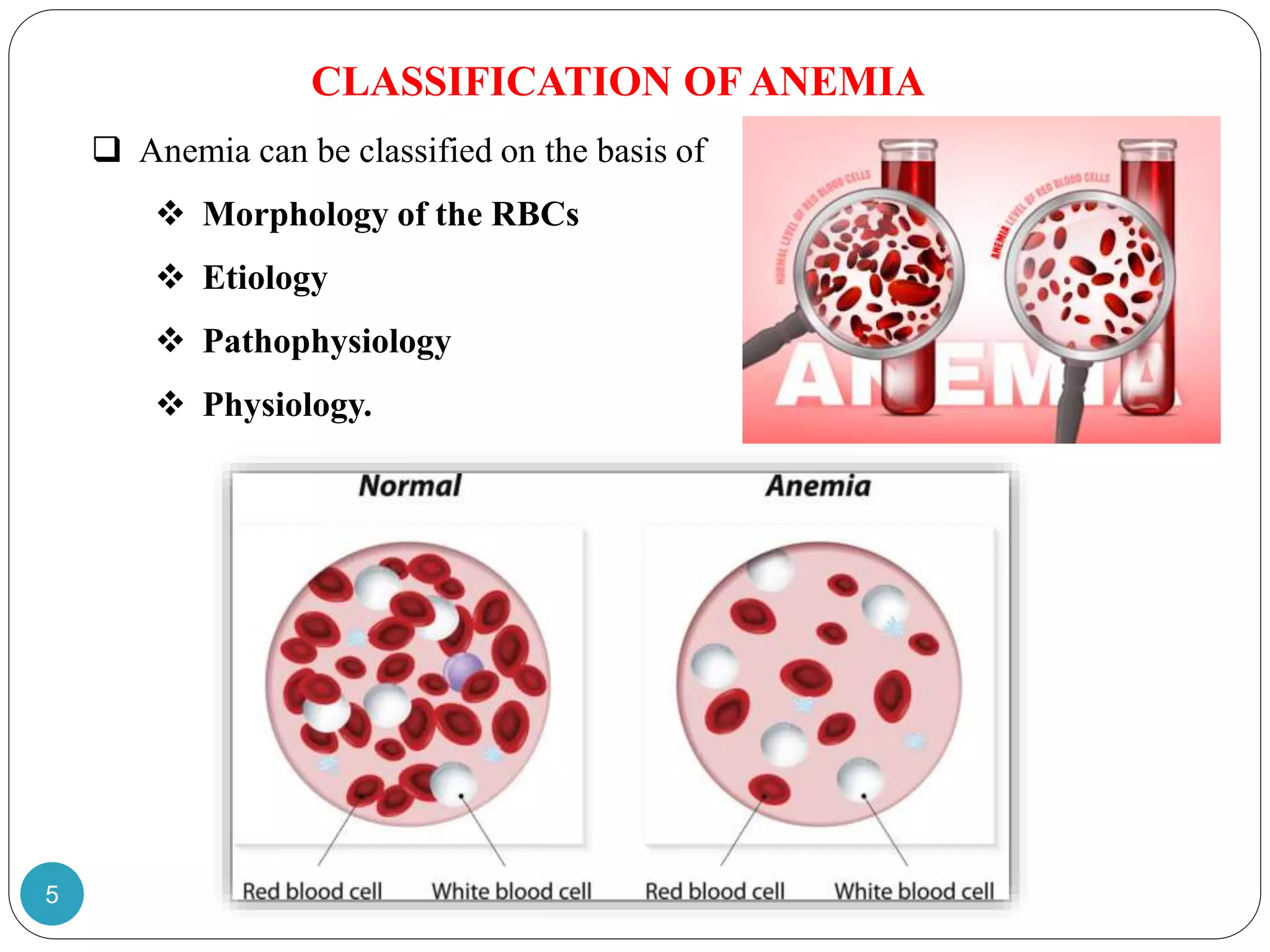 Anemia.pptx