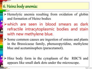 ANEMIA.ppt