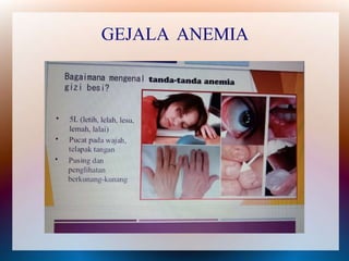 anemia.ppt