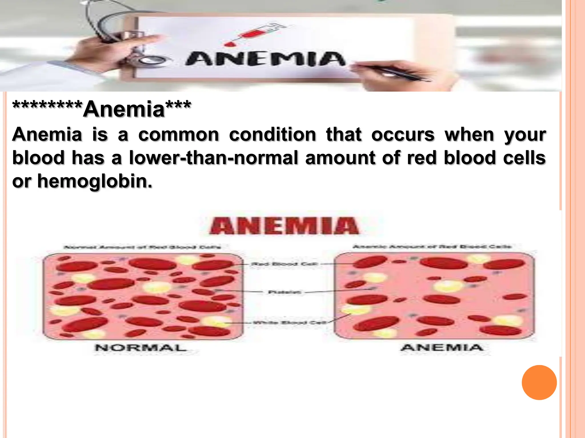 Anemia.pptx